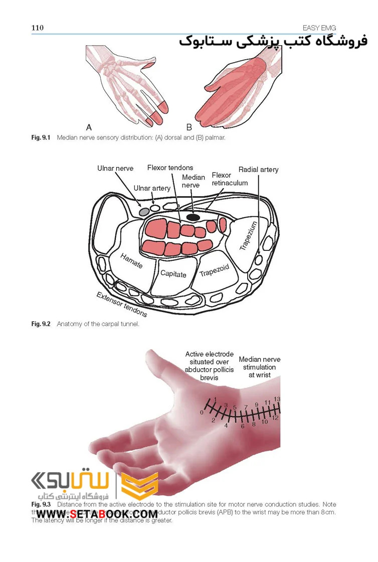 Easy EMG : A Guide to Performing Nerve Conduction Studies and ...